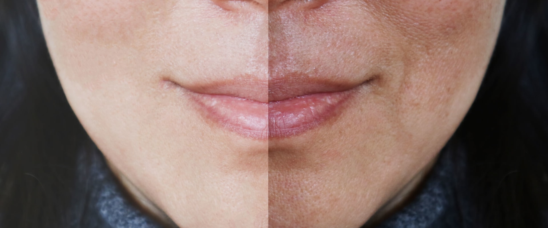 The Benefits of a HydraFacial: Get Refined Pores and Glowing Skin